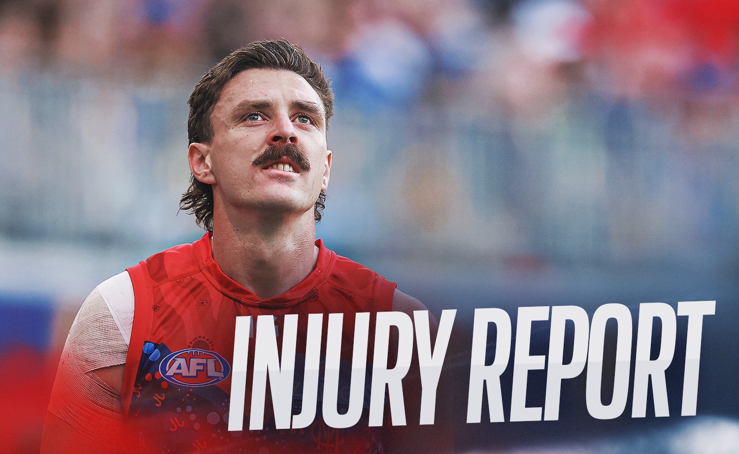 Injury Report | Lever to miss