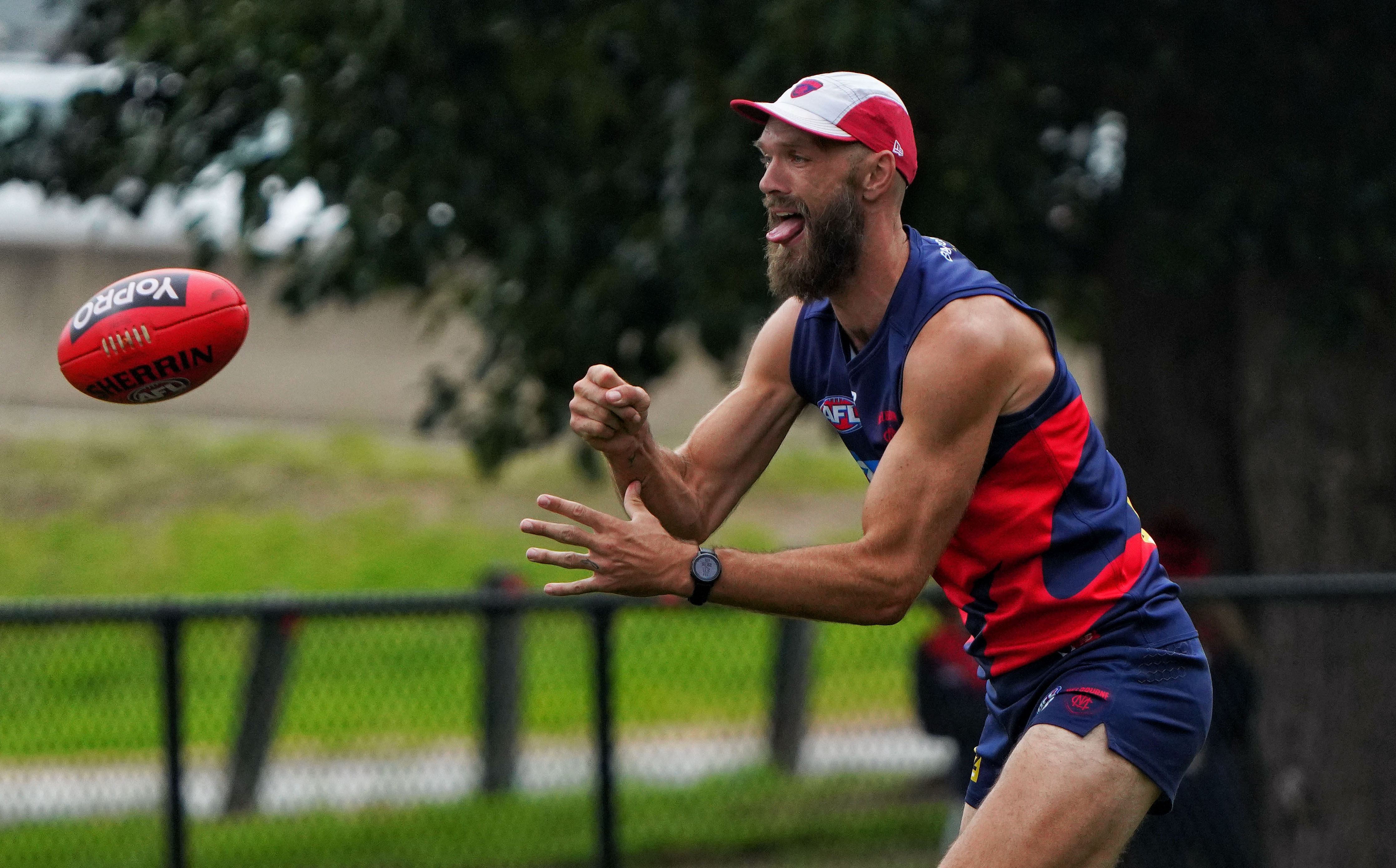 Injury Update | Demons eye February footy